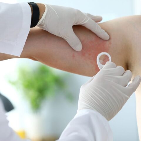 Shingles Pain Management | Louisiana Pain Specialists